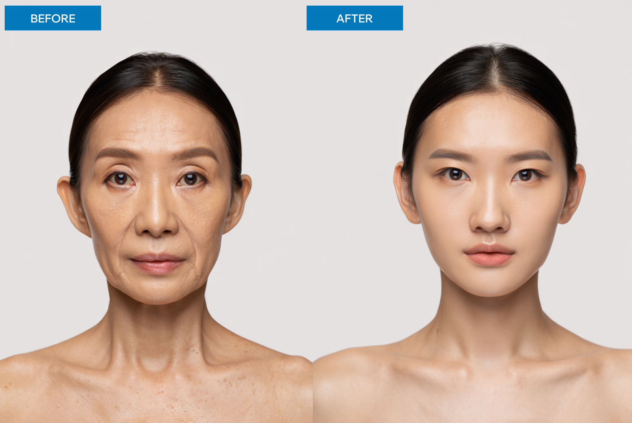 Loss of Firmness & Sagging Skin Treatment | Prime Aesthetics